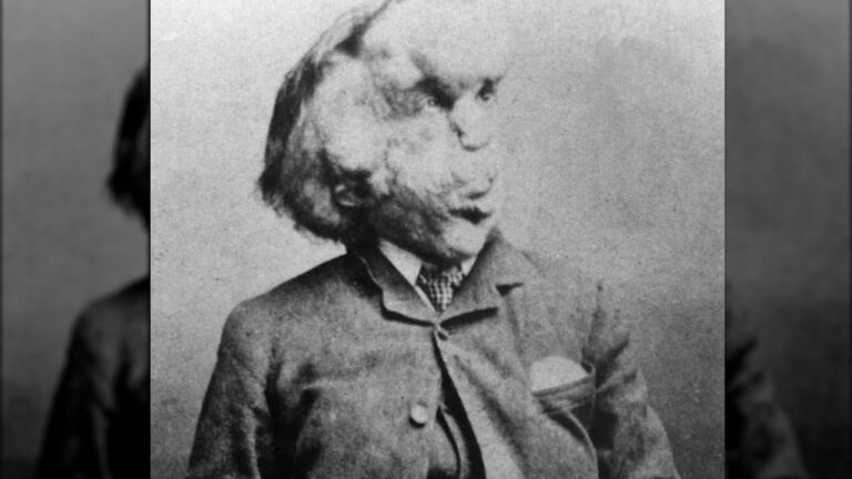 Joseph Merrick: "Fil Adam" - Evren Atlası